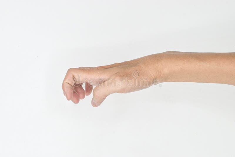 Complete Claw Hand Abnormality Stock Photo - Image of fingers, abnormal ...