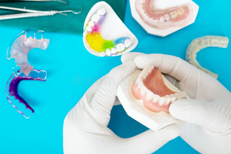 Complete Denture or Full Denture. Stock Photo - Image of full, plastic ...