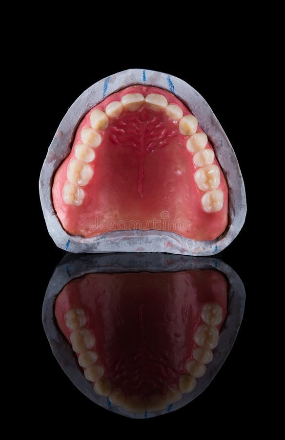 Complete maxillary denture stock image. Image of care - 206763563