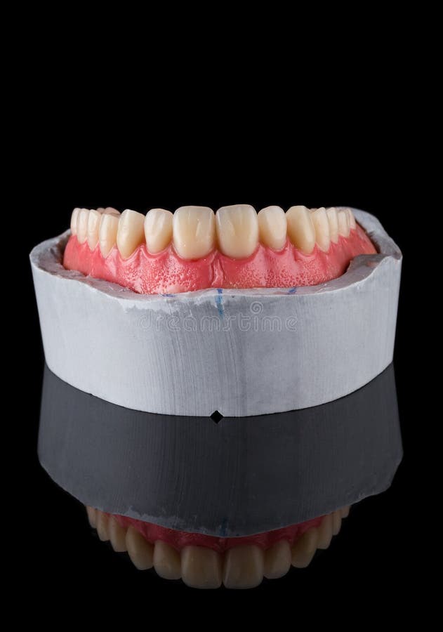Complete Maxillary Denture â€“ Wax-Up and Gingival Contouring Stock ...