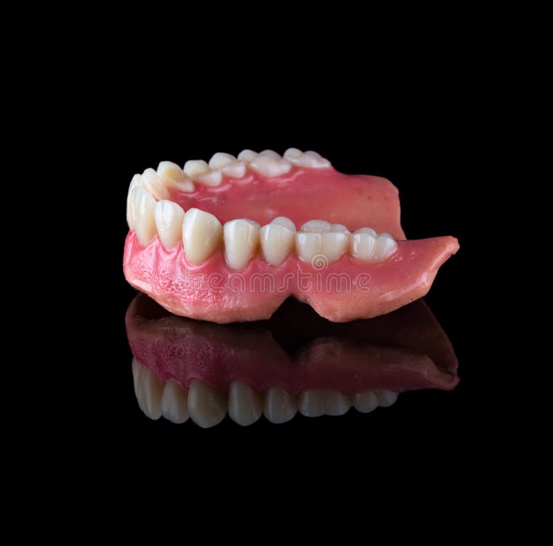 Complete Maxillary Denture â€“ Wax-Up and Gingival Contouring Stock ...