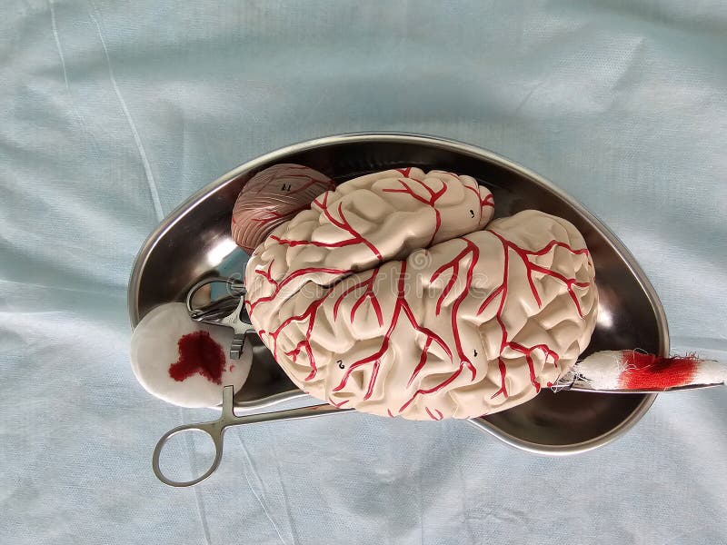 Complex Brain Surgeries. Brain Surgery Tumor Removal Concept Stock ...