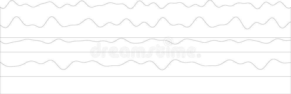 Complex Brainwave Activity Displayed in Eeg Graph Stock Illustration ...