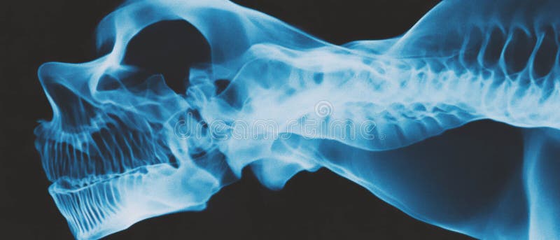 Complex X-ray Texture Depicting Layered Structures and Dimensional ...