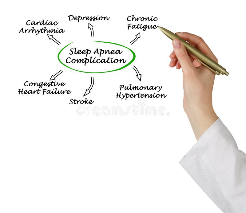 Complication of Sleep Apnea Stock Image - Image of cardiology, screen ...