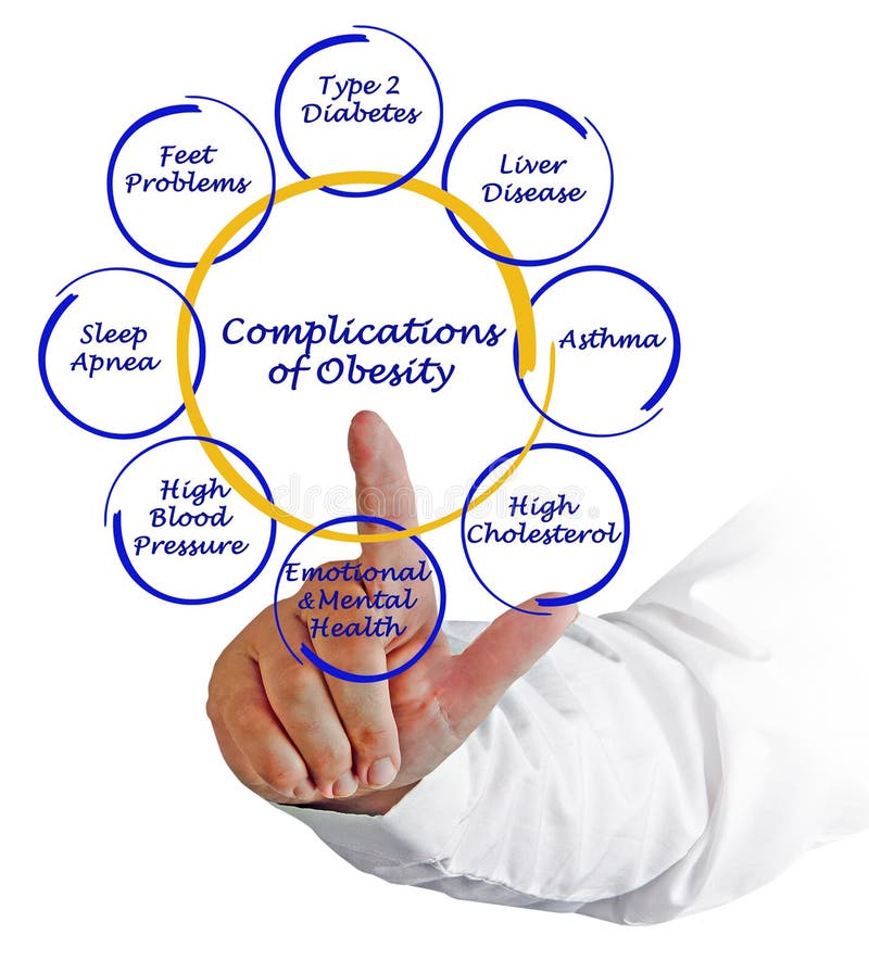 Complications of Obesity stock photo. Image of healthcare - 85634682
