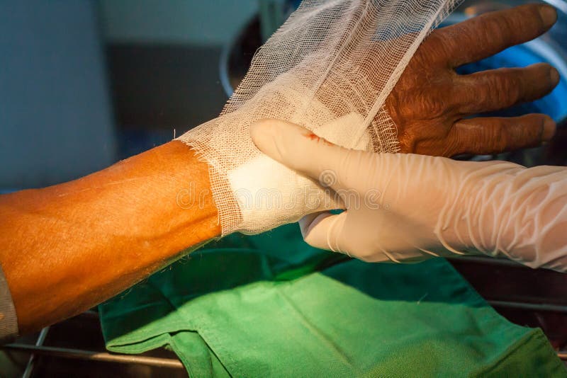 724 Compression Wound Photos - Free & Royalty-Free Stock Photos from ...