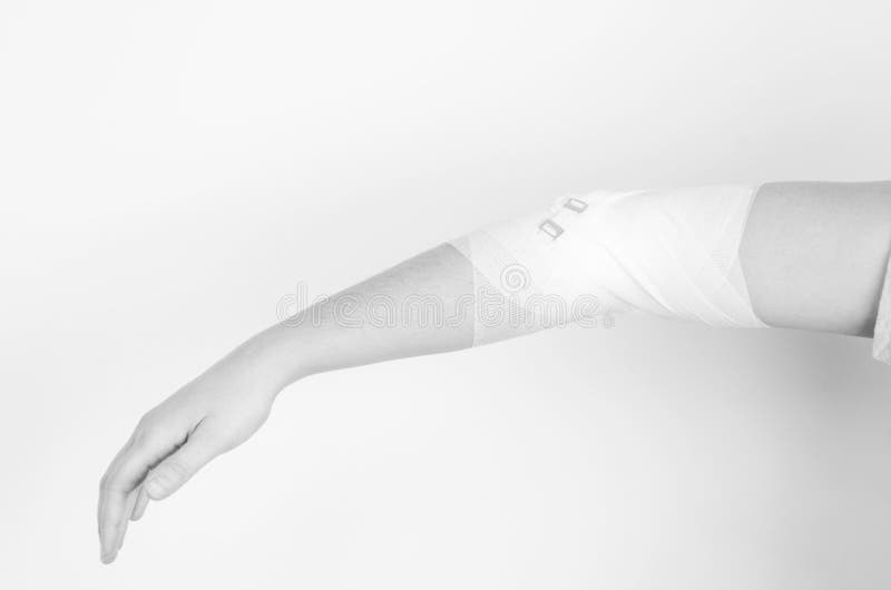 Compression Bandage To Inflammation, Application of Figure of Eight ...