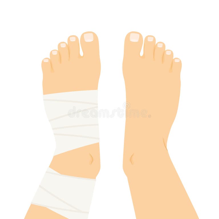 Compression Bandage Wrapped Around the Twisted Ankle Stock Vector ...