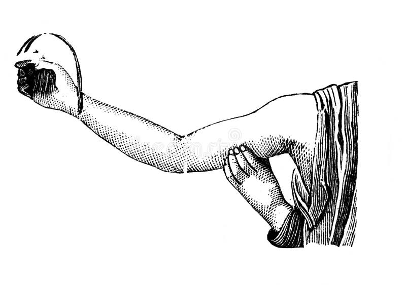 Compression of the Brachial Artery in the Old Book the Elementary ...