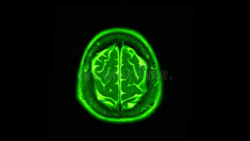 Human Brain Scan Mri Brain Scan Computed Tomography Of The Human Brain Stock Video Video Of