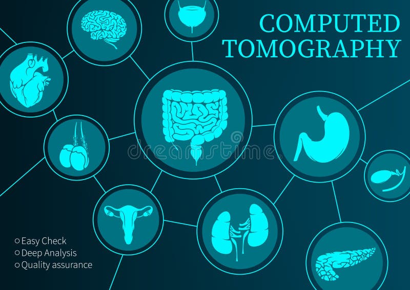 Colon Computed Tomography Stock Illustrations – 8 Colon Computed ... Colon Computed Tomography Stock Illustrations – 8 Colon Computed ...