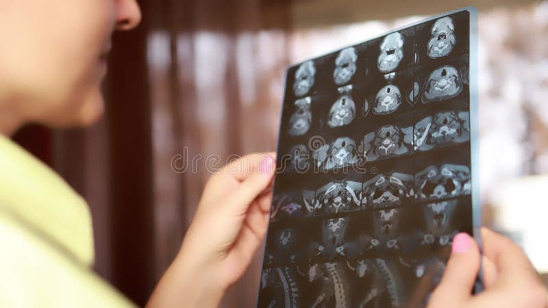 A Doctor Examines a Computed Tomography Scan of the Thyroid Gland on a ...