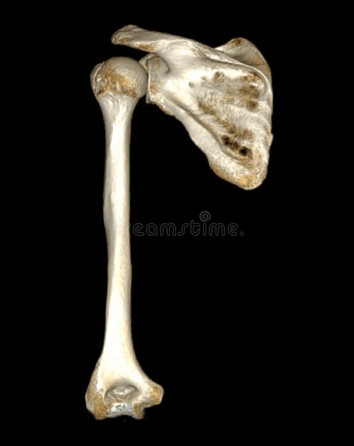 CT Scan of Shoulder Joint and Humerus Bone or Arm Stock Illustration ...