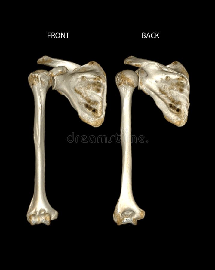 CT Scan of Shoulder Joint and Humerus Bone or Arm Stock Illustration ...