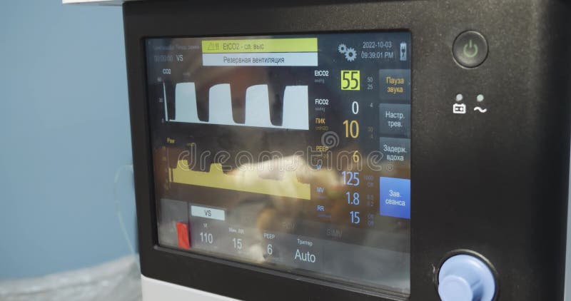 Computer Monitor of the Artificial Lung Ventilation Apparatus. the ...
