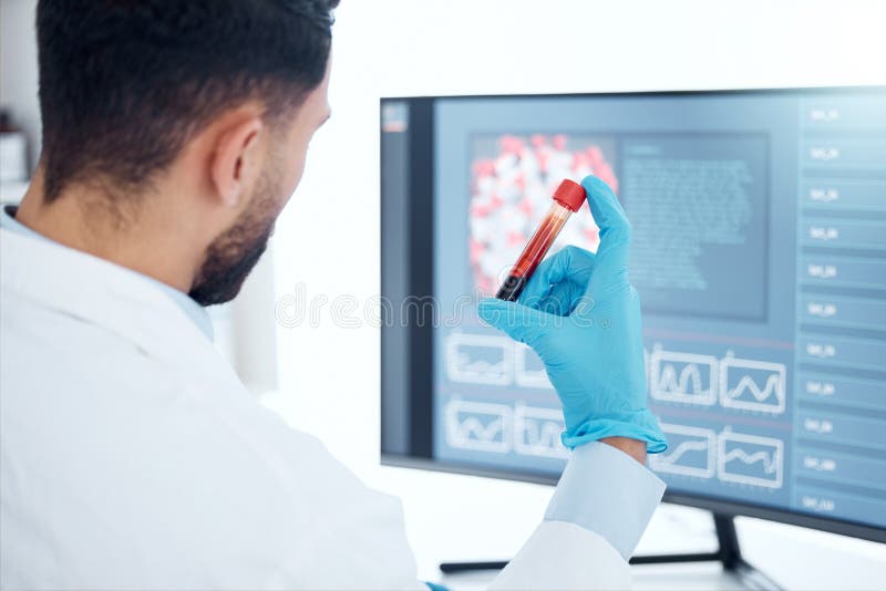 Computer Screen, Ppe and Blood Sample in Laboratory for Science ...