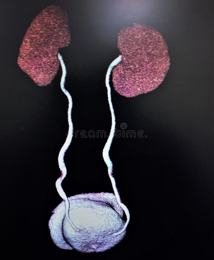Computer Tomography 3d Imaging Urology Stock Image - Image of ...