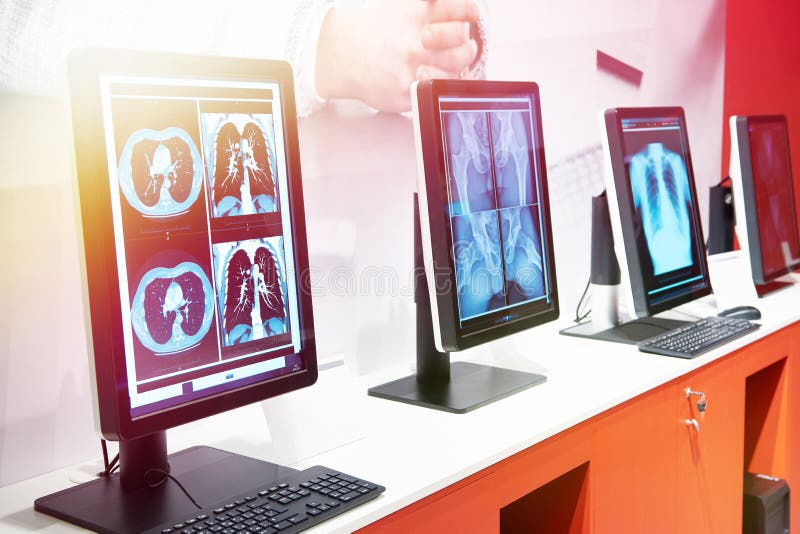 Computers and Monitors with Schematic Diagram for Supervisory, Control ...