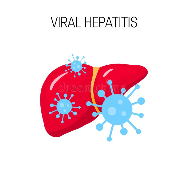 Conceito Do Vetor Da Hepatite Viral Ilustração Stock - Ilustração de ... Conceito Do Vetor Da Hepatite Viral Ilustração Stock - Ilustração de ...