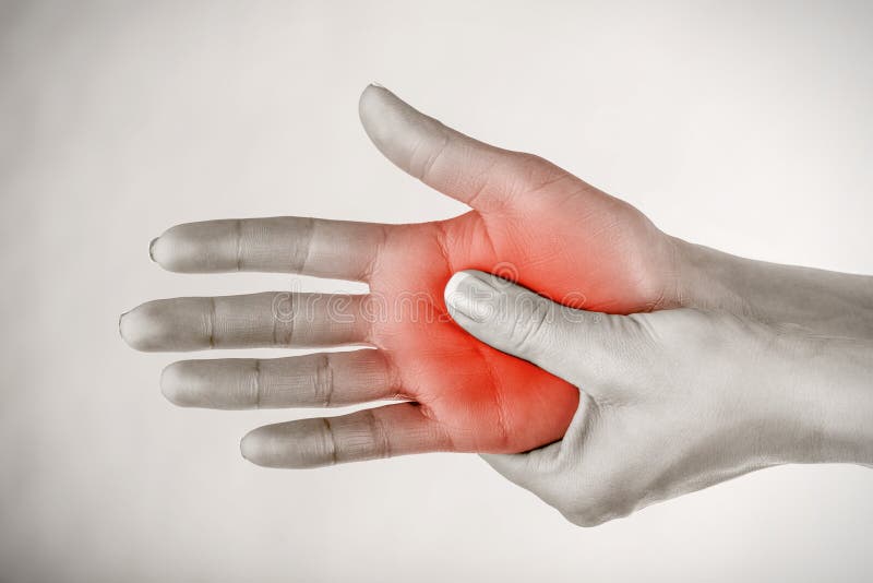 Douleur musculaire de main image stock. Image du douloureux - 80367579