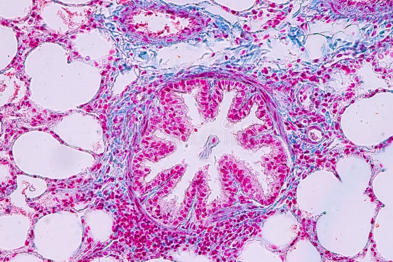 Concept of Education Anatomy and Human Lung Tissue Under Microscope ...