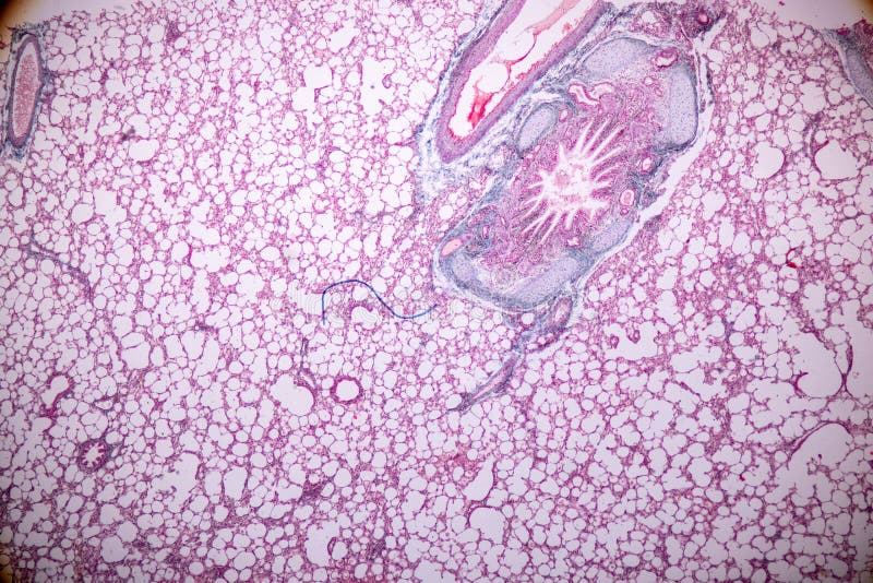 Concept of Education Anatomy and Human Lung Tissue Under Microscope ...