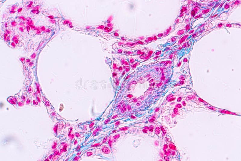Concept of Education Anatomy and Human Lung Tissue Under Microscope ...