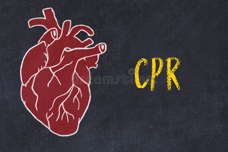 Cpr Drawing Stock Illustrations – 119 Cpr Drawing Stock Illustrations ...
