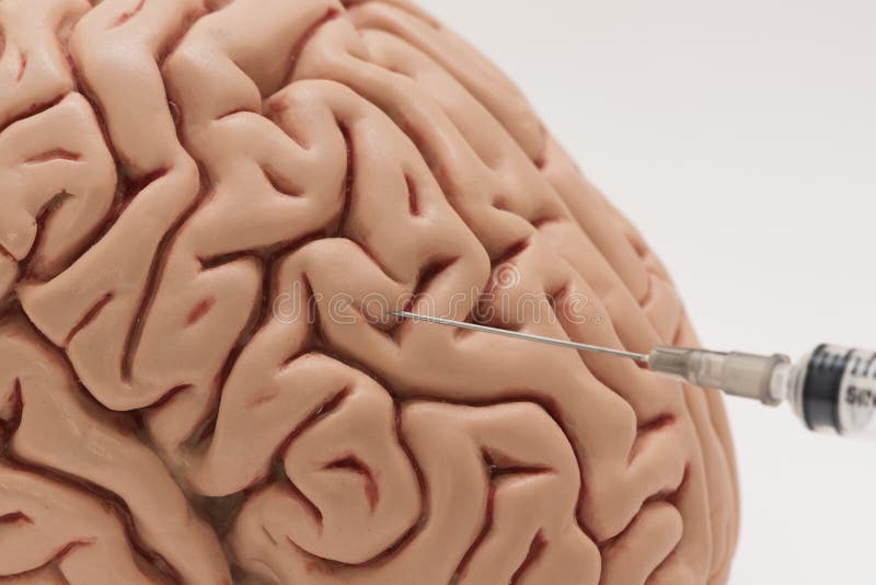 Syringe Needle and Human Brain Model on White Background Stock Photo ...