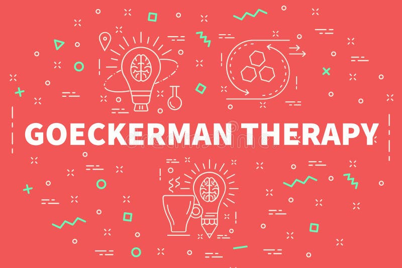 Goeckerman Therapy Stock Illustrations – 1 Goeckerman Therapy Stock ...