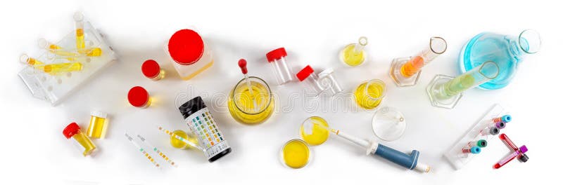 Conceptual Image on Urine Alysis, Dipstick, Urine Vials,Urine Tests ...