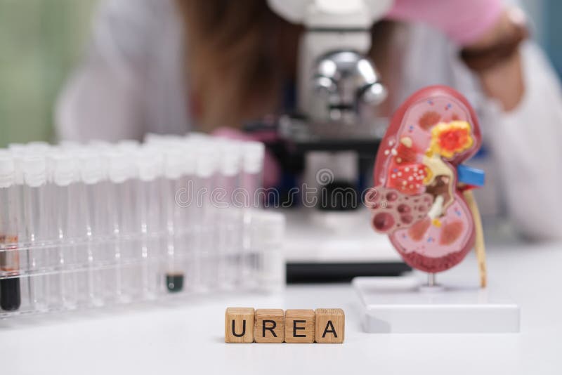 Microscopic Study of a Kidney Model and Urea Analysis in Laboratories ...