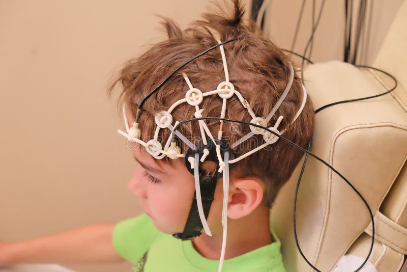 Conducting EEG for a child stock photo. Image of inspection - 73649380