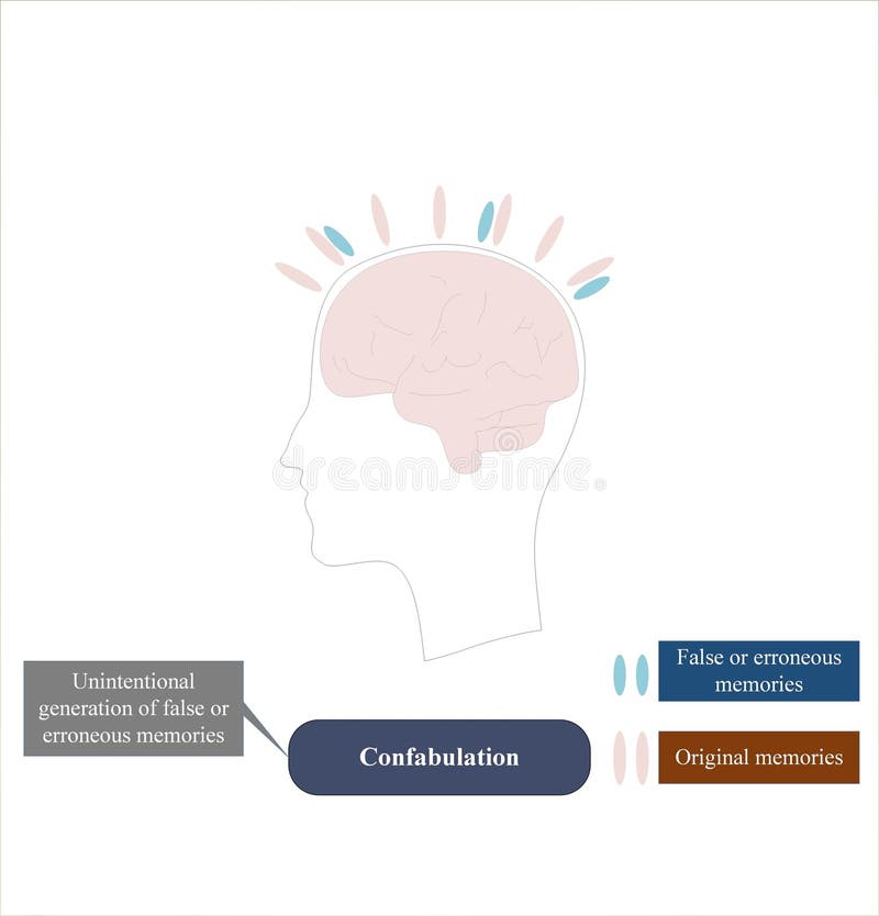 Confabulation is Unintentional Generation of False Memories Stock Photo ...