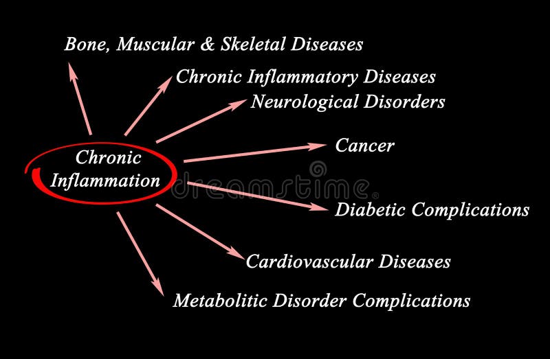 Chronic Inflammation stock illustration. Illustration of food - 102727764