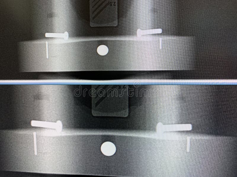 Constant Exposure for Measuring and Calibrating an X-ray Scanner Stock ...