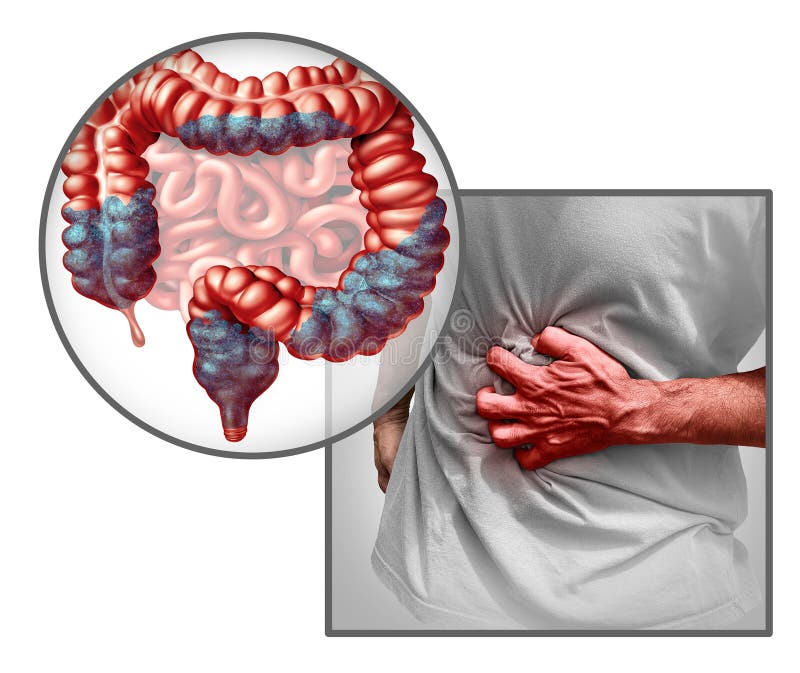 Feeling Constipated stock image. Image of feeling, isolated - 276948769