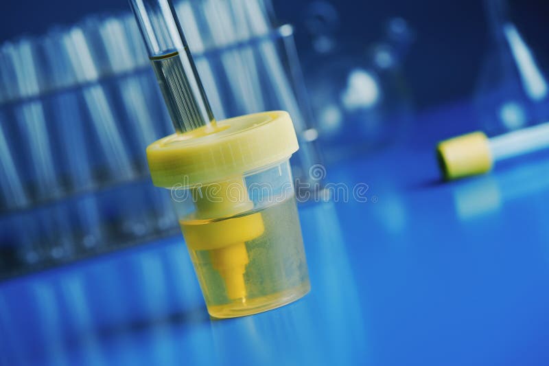 Container with a Sample of Urine in the Laboratory Stock Image - Image ...