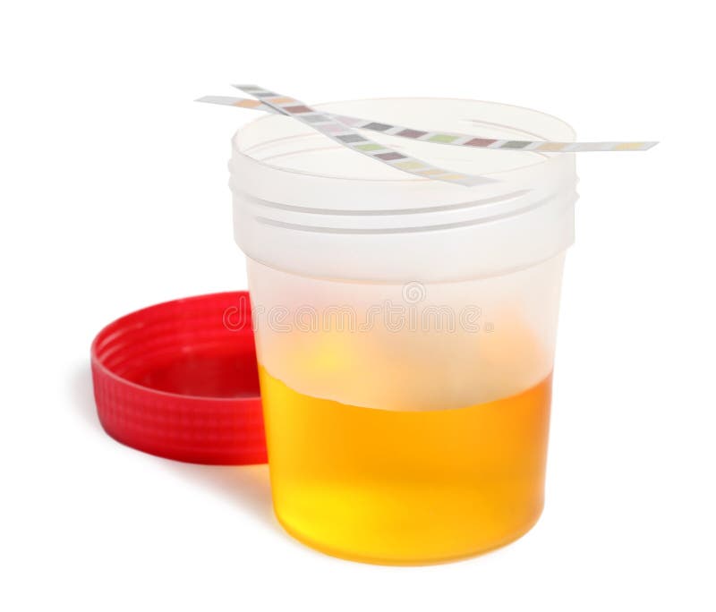 Container with Urine Sample for Analysis and Test Strips on White ...