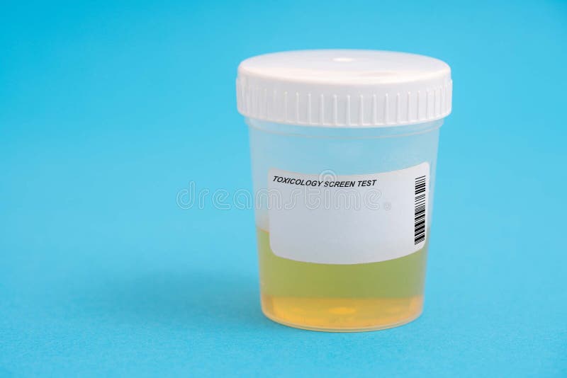Container with a Urine Sample for Laboratory Analysis Stock Photo ...