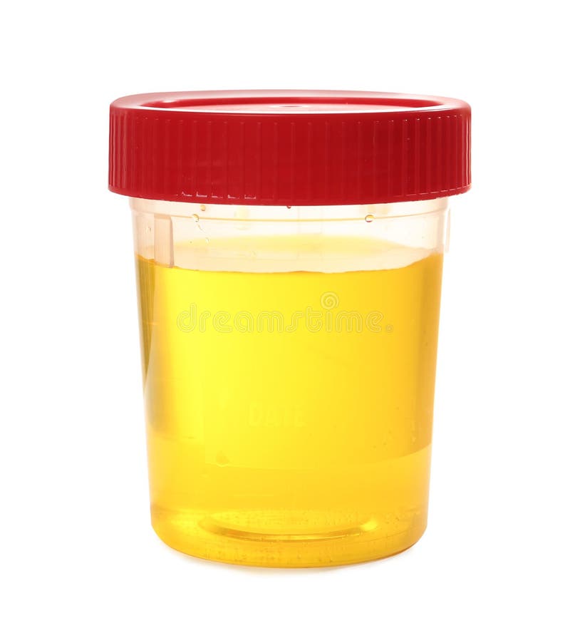 Container with Urine Sample for Analysis, Litmus Paper and Medical ...