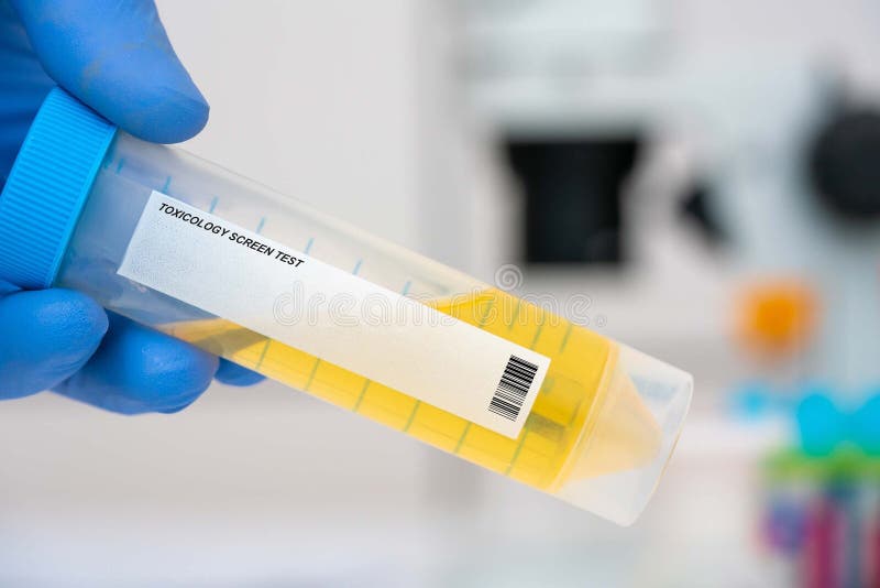 Container With A Urine Sample For Microbiological Laboratory Analysis In The Hand Of Laboratory