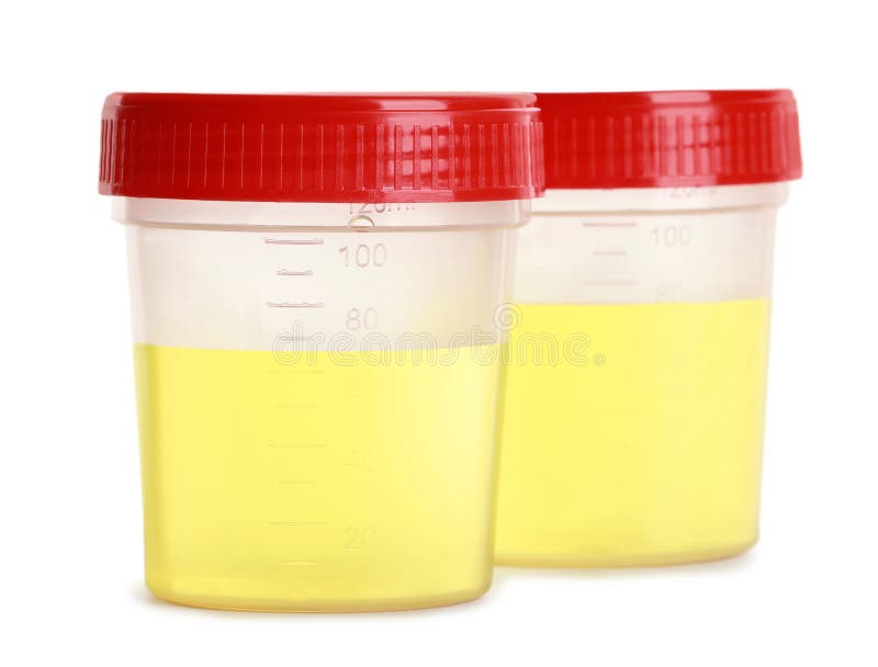 Urine Jars Stock Photos - Free & Royalty-Free Stock Photos from Dreamstime