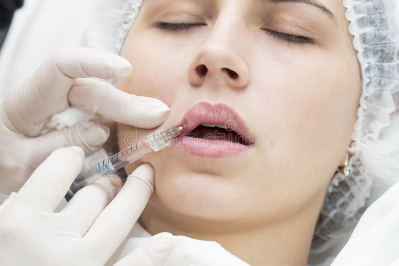 Contour plastic lips stock image. Image of contour, needle - 71657587