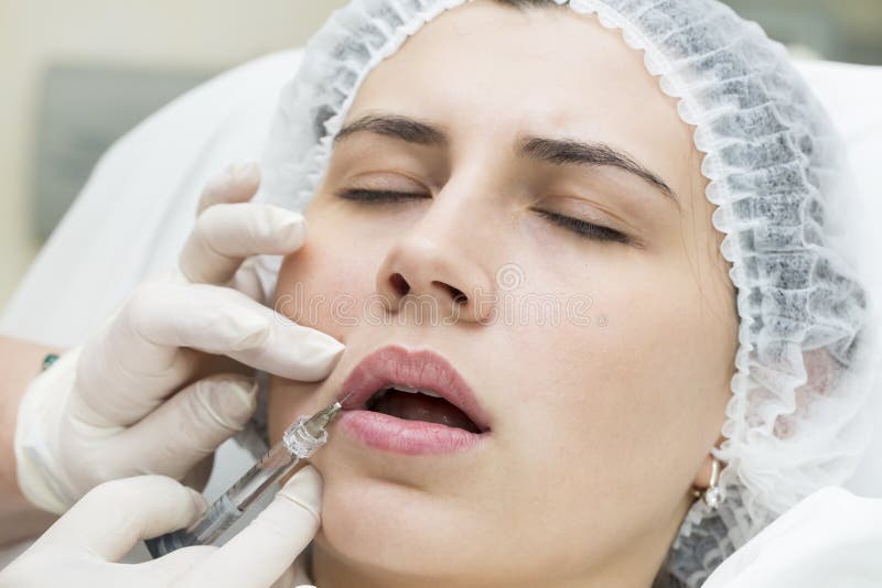 Contour plastic lips stock photo. Image of needle, cosmetic - 71657678