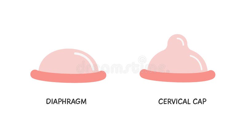 Contraceptive Diaphragm and Cervical Cap Colored Flat Style Icons ...