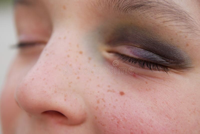 Contusion stock image. Image of insurance, bruising, macro - 30769475