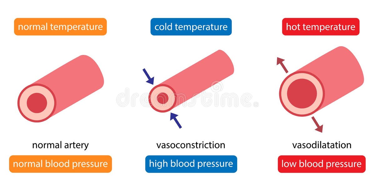 Vasoconstriction Stock Illustrations – 258 Vasoconstriction Stock ...