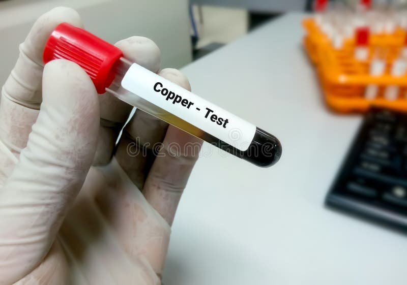 Copper (cu) Test. Blood Toxicity Testing Stock Photo - Image of ...